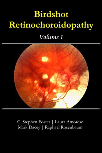 Birdshot Retinochoroidopathy: Volume 1: Foster, C. Stephen, Amorese ...