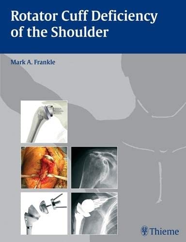 Rotator Cuff Deficiency of the Shoulder: 9781588905062: Medicine ...