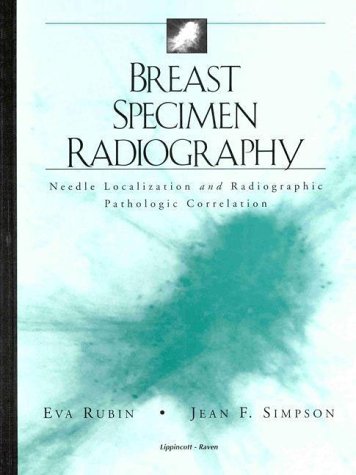Breast Specimen Radiography: Needle Localization and Radiological ...
