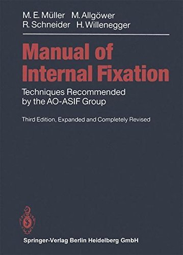 Manual of INTERNAL FIXATION: Techniques Recommended by the AO-ASIF Group by Maurice E. M??ller ...