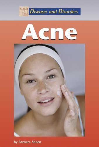 Acne (Diseases and Disorders): Bunting, Eve: 9781590183458: Amazon.com ...
