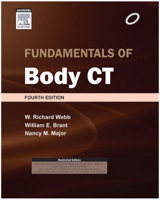 Fundamentals of Body CT, 4 Ed.: Webb: 9788131239902: Amazon.com: Books
