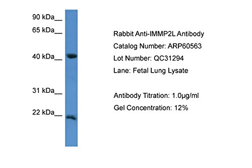 Amazon.com: anti-IMP2 Inner Mitochondrial Membrane Peptidase-Like (S ...