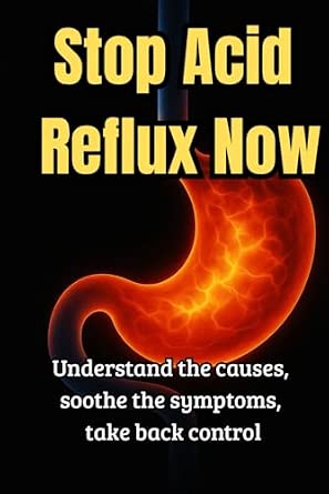 Stop Acid Reflux Now: Simple Methods, Effective Solutions, and an ...