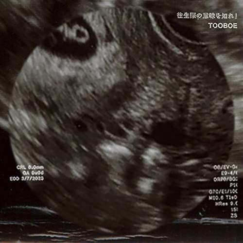 Amazon MusicでTOOBOEの往生際の意味を知れ！を再生する