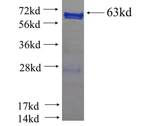 Amazon.com: Human INO80 Fusion Protein : Industrial & Scientific
