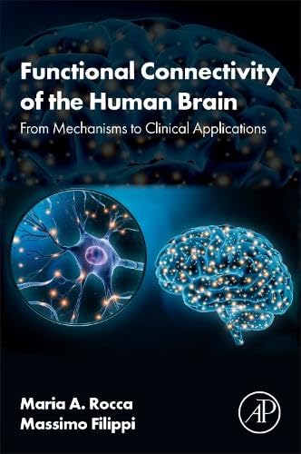 Amazon | Functional Connectivity of the Human Brain: From Mechanisms to ...