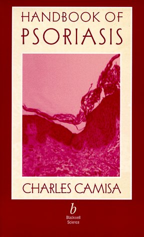 Buy Handbook of Psoriasis Book Online at Low Prices in India | Handbook ...