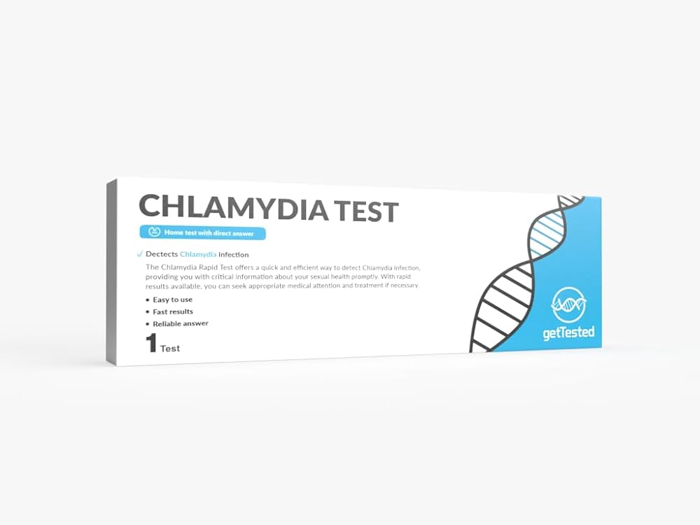 chlamydia test on men