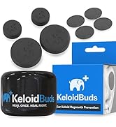 Amazon.com: CauliBuds™ Cauliflower Ear Magnets - Premium Silicone ...