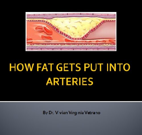 How Fats Get Put Into Arteries (Natural Hygiene) - Kindle edition by ...