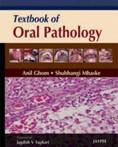 Textbook of Oral Pathology: 9788184484021: Medicine & Health Science ...