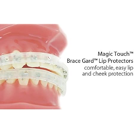 Amazon.com: Our BestSeller Orthodontic Braces Lip Guard Protector ...