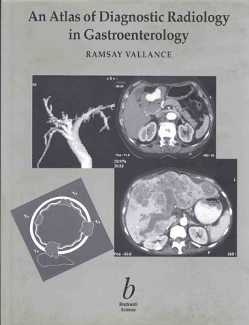 An Atlas of Diagnostic Radiology in Gastroenterology: 9780632050222 ...