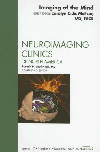 Imaging the Mind, An Issue of Neuroimaging Clinics (Volume 17-4) (The ...
