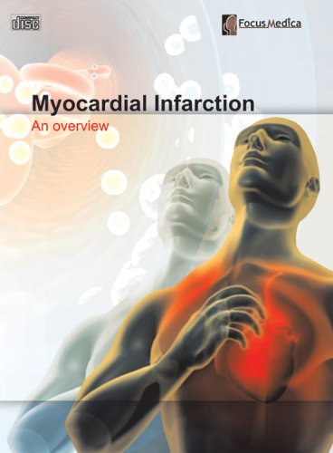 Myocardial Infarction: An Overview (Cardiovascular Medicine): Focus ...