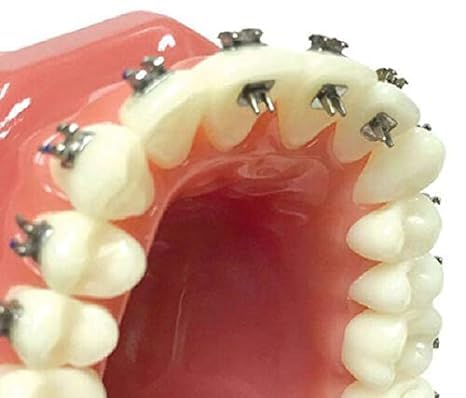 Amazon.com : 10 pieces Dentalmall Lingual rest Bite Turbos Openner ...