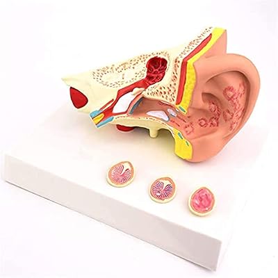 1.5x Life-Size Educational Ear Pathology Model for Philippines | Ubuy