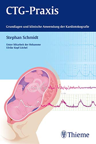CTG-Praxis: Grundlagen und klinische Anwendung der Kardiotokografie ...