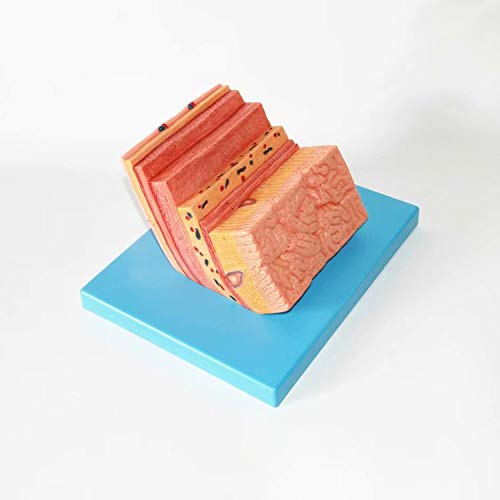 Hx Human Organ Models Stomach Wall Enlargement Model Digestive System ...