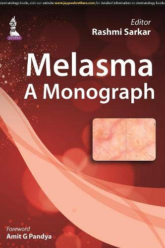 Melasma: A Monograph: 9789351525431: Medicine & Health Science Books ...
