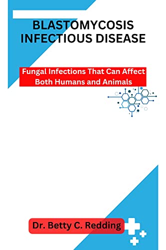 BLASTOMYCOSIS INFECTIOUS DISEASE: Fungal Infections That Can Affect ...