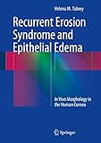 【発売日：2014年11月17日】・製造元:Springer