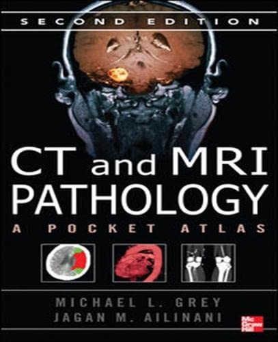 CT & MRI Pathology: A Pocket Atlas, Second Edition (Int'l Ed): Michael ...