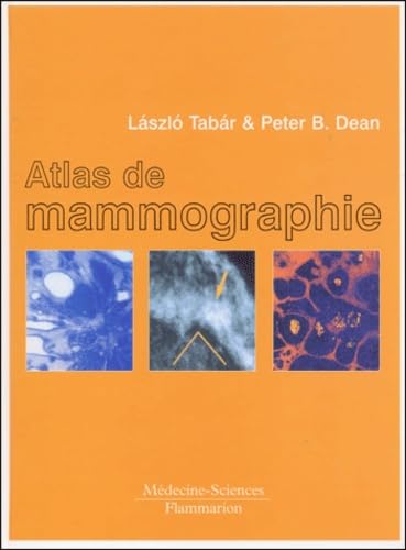 Amazon.com: ATLAS DE MAMMOGRAPHIE: 9782257110510: TABAR LAZLO: Books