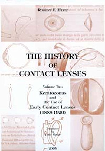 The History of Ophthalmology : History of Contact Lenses (2 ...