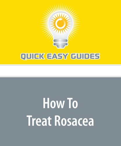 How To Treat Rosacea: unknown author: 9781440009204: Amazon.com: Books