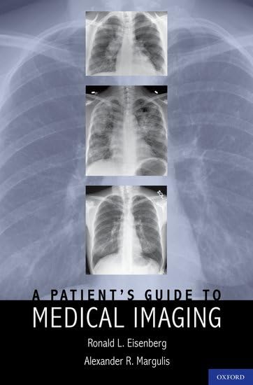 A Patient's Guide to Medical Imaging: 9780199729913: Medicine & Health ...