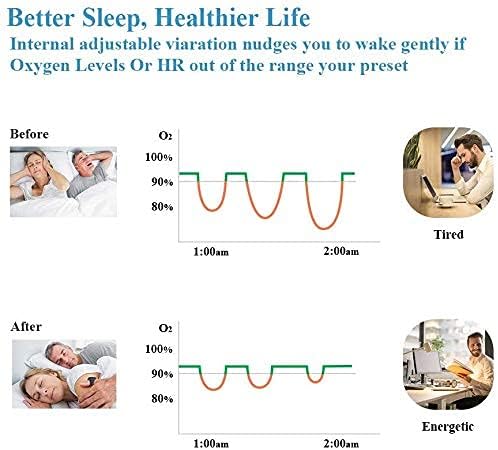 ViATOM Sleep Monitor with APP, Vibration Alarm, Heart Rate for ...