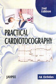 Practical Cardiotocography: A.K. Debdas: 9788180614965: Amazon.com: Books