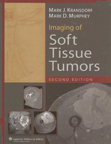 Imaging of Soft Tissue Tumors: 9780781747714: Medicine & Health Science ...