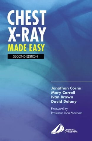 Chest X-Ray Made Easy: 9780443070082: Medicine & Health Science Books ...