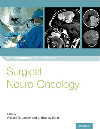 20 Best Neurosurgery Books of All Time - BookAuthority