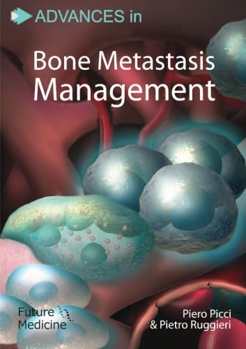Advances in Bone Metastasis Management: 9781780841151: Medicine ...