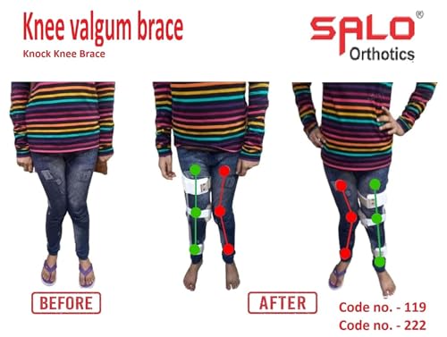 SALO Orthotics Knee Genu Valgum Genu Varum Knock Knee & Bow Leg Support ...