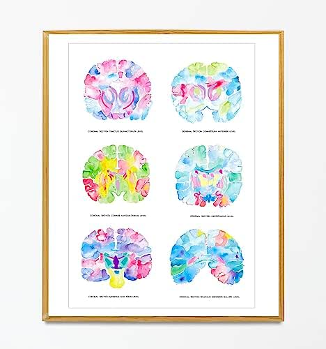 Amazon.com: Neurology Art, Brain Art, Neuroscience Decor, Neurosurgery ...
