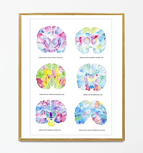 Amazon.com: Neurology Art, Brain Art, Neuroscience Decor, Neurosurgery ...