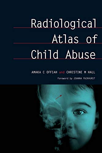 Radiological Atlas of Child Abuse: A Complete Resource for MCQs, v. 1 ...