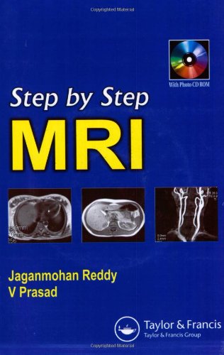 Step by Step MRI: 9781841845371: Medicine & Health Science Books ...