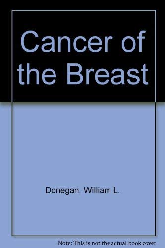 Amazon | Cancer of the Breast | Donegan, William L., Spratt, John S ...