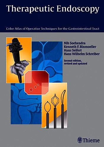 Buy Therapeutic Endoscopy: Color Atlas of Operative Techniques for the ...