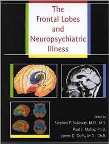 The Frontal Lobes and Neuropsychiatric Illness: Amazon.co.uk: Salloway ...