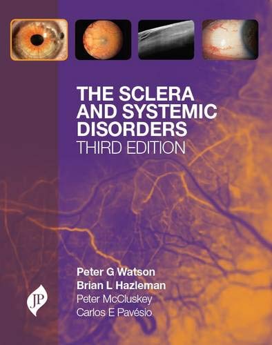 The Sclera and Systemic Disorders: 9781907816079: Medicine & Health ...
