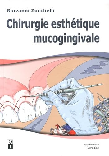 Amazon.com: Chirurgie esthétique mucogingivale: 9782366150155: Giovanni ...