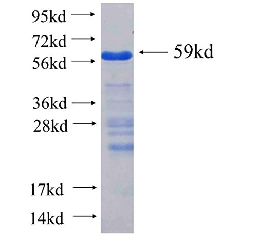 Amazon.com: Human IKZF2 Fusion Protein : Industrial & Scientific