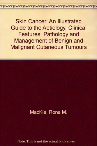 Skin Cancer: An Illustrated Guide to the Aetiology, Clinical Features ...